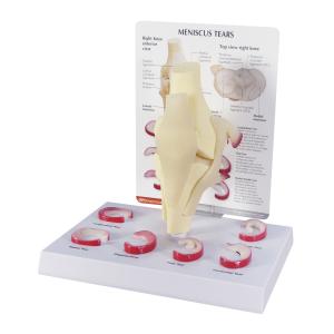 Joint Models & Bone Models
