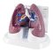 Cancer Models