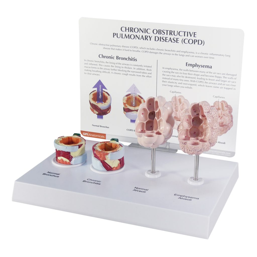 COPD - Model #3130 - GPI Anatomicals