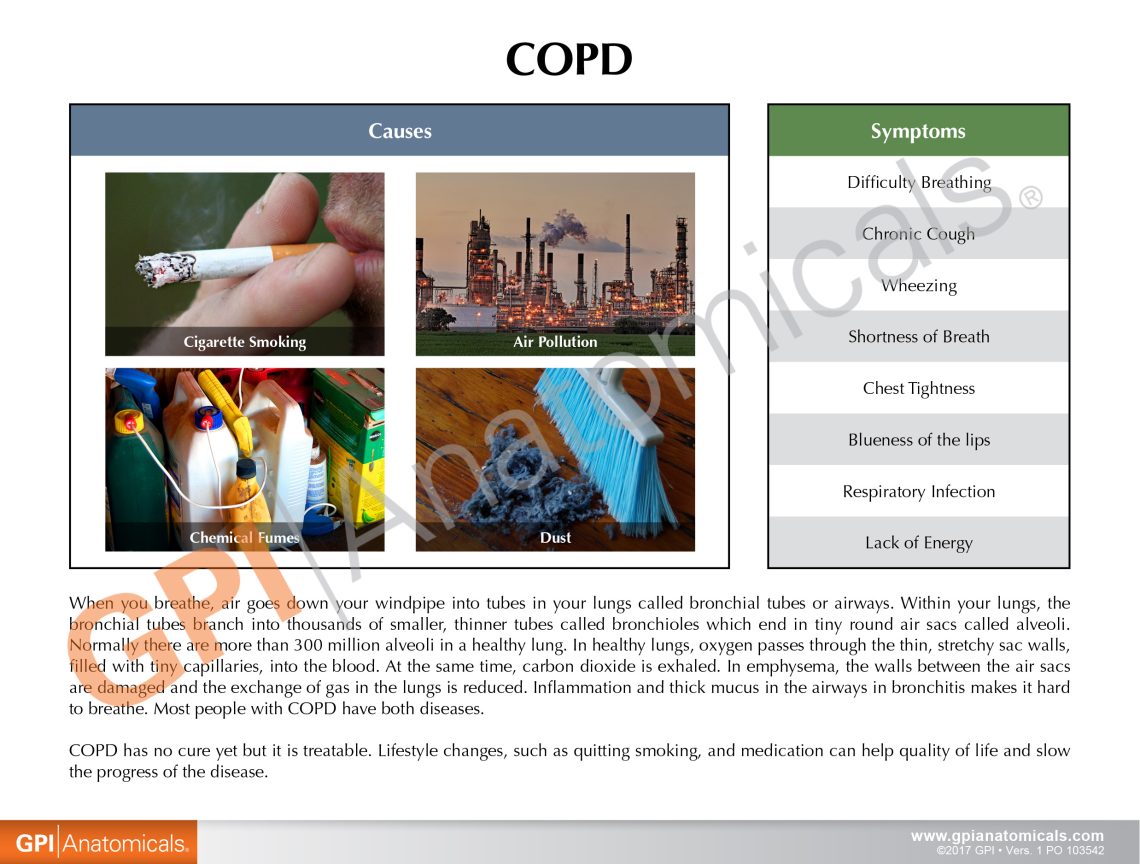 COPD - Model #3130 - GPI Anatomicals