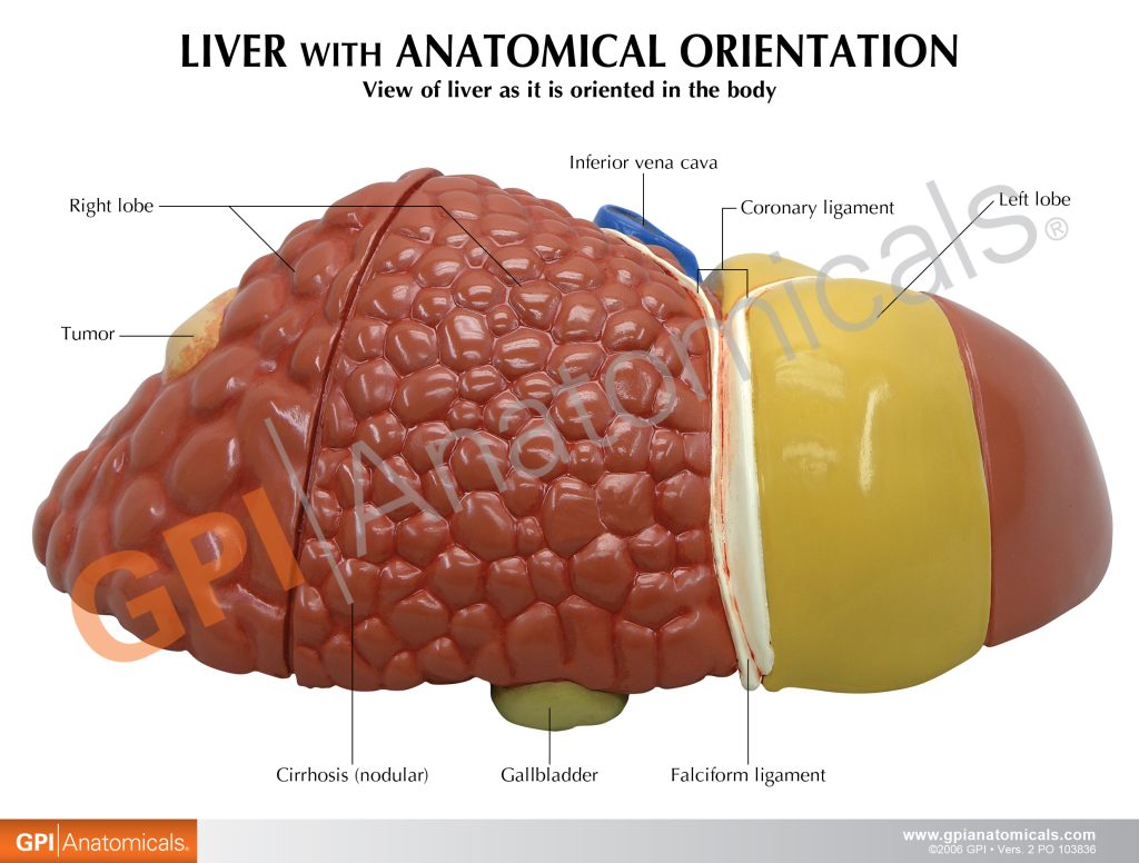 Liver with Pathologies - Model #3310 - GPI Anatomicals