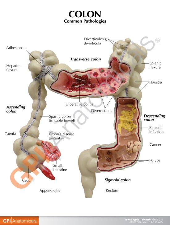 Colon - Model #3340 - GPI Anatomicals