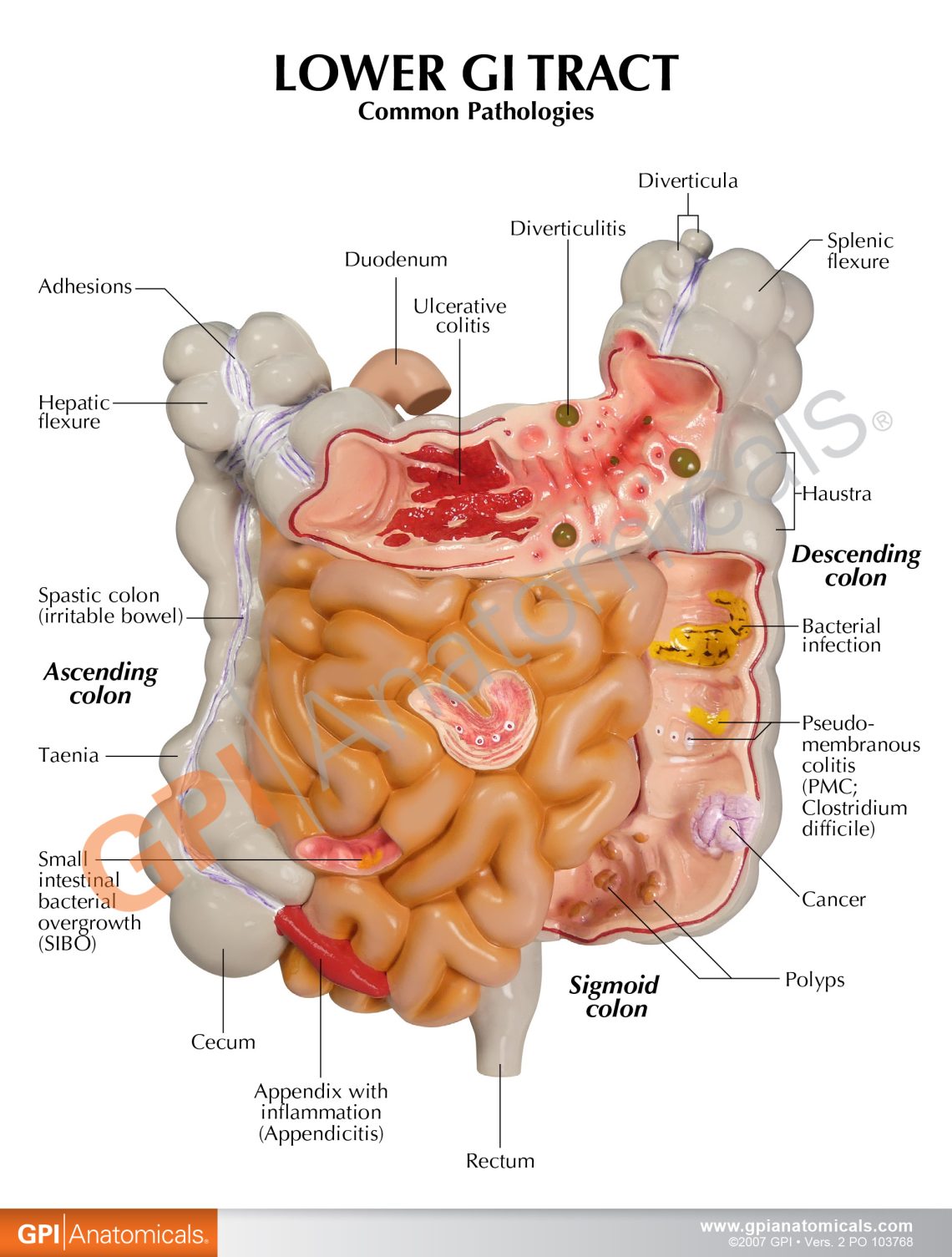 GI Tract - Model #3342 - GPI Anatomicals