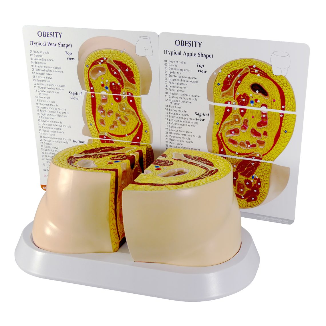 Obesity - Model #3600 - GPI Anatomicals