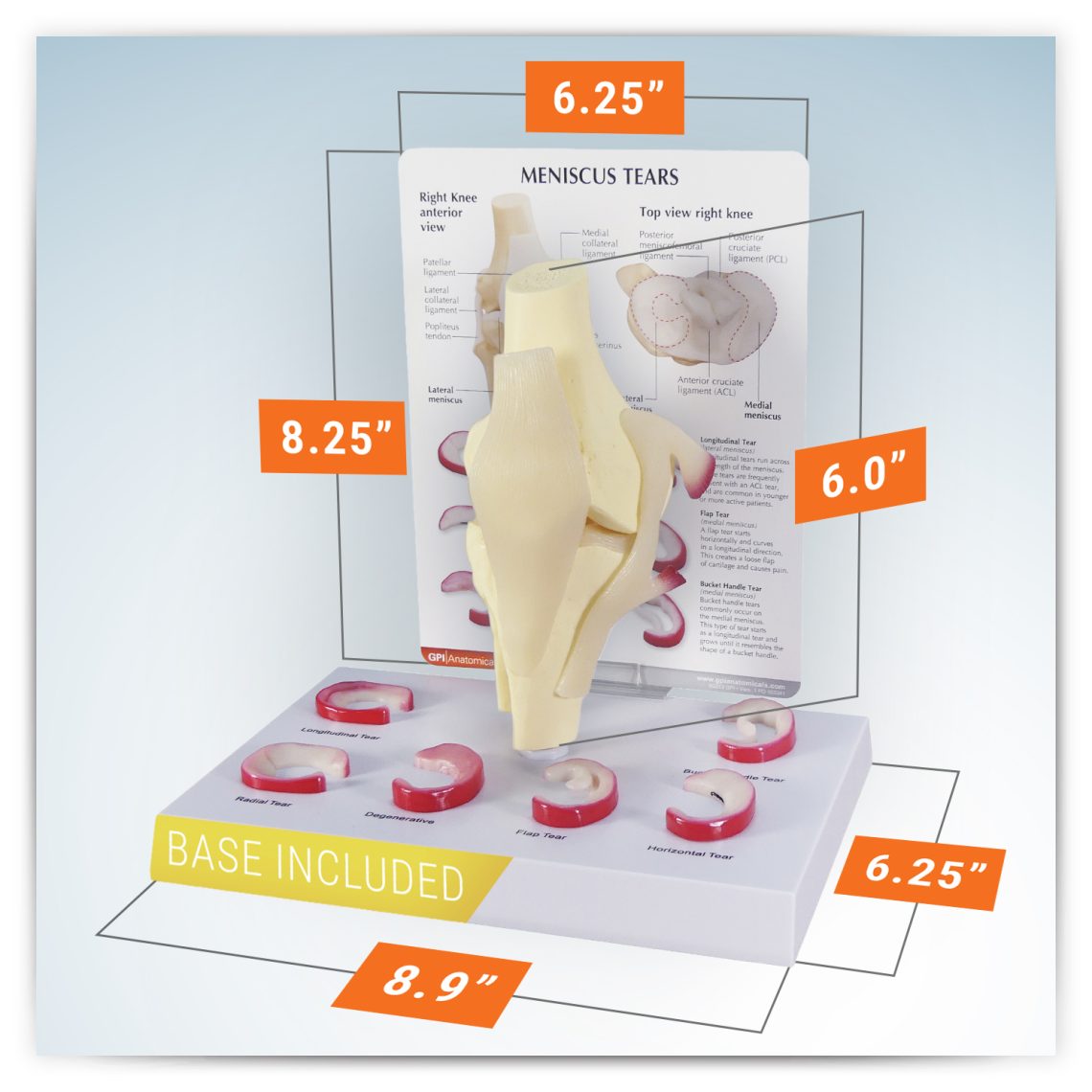 Meniscus Tears - Model #1010 - GPI Anatomicals