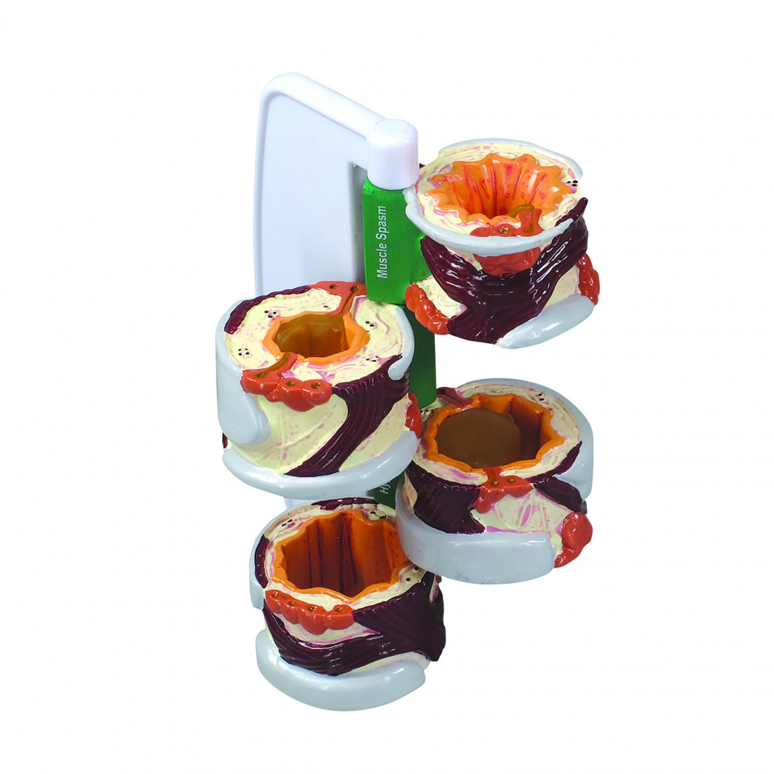 4-Pc Bronchus - Model #3120 - GPI Anatomicals