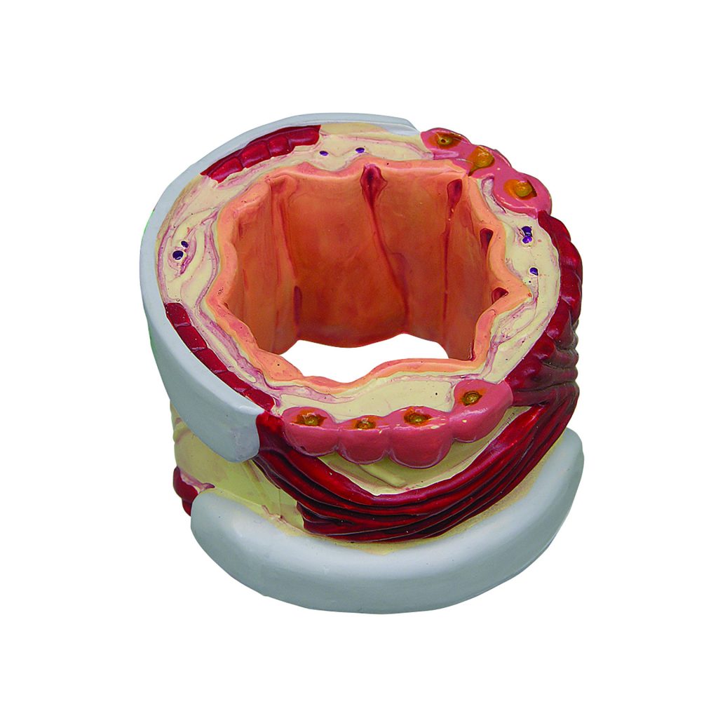 4-Pc Bronchus - Model #3120 - GPI Anatomicals