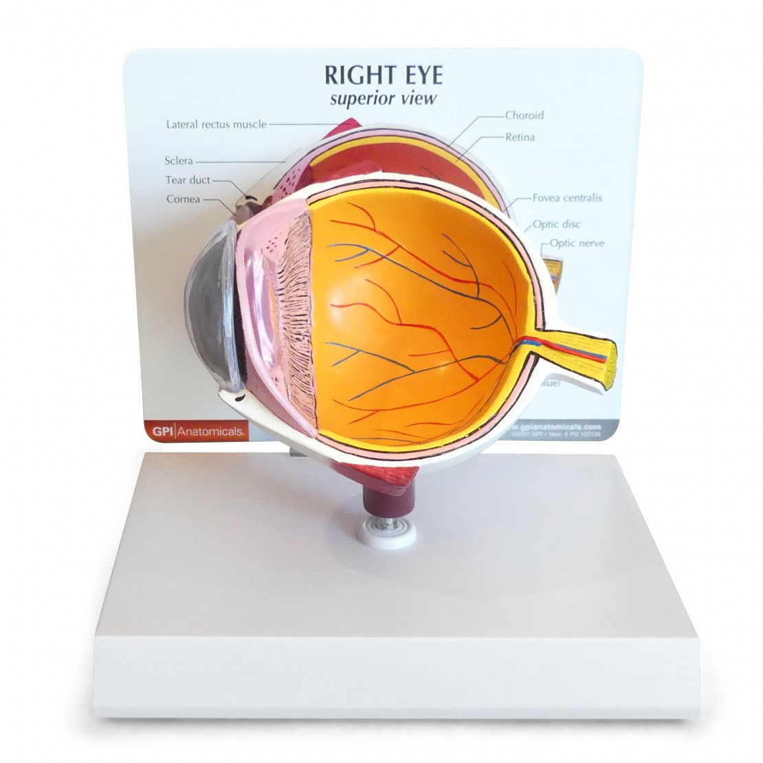 Cataract Eye - Model #2800 - GPI Anatomicals