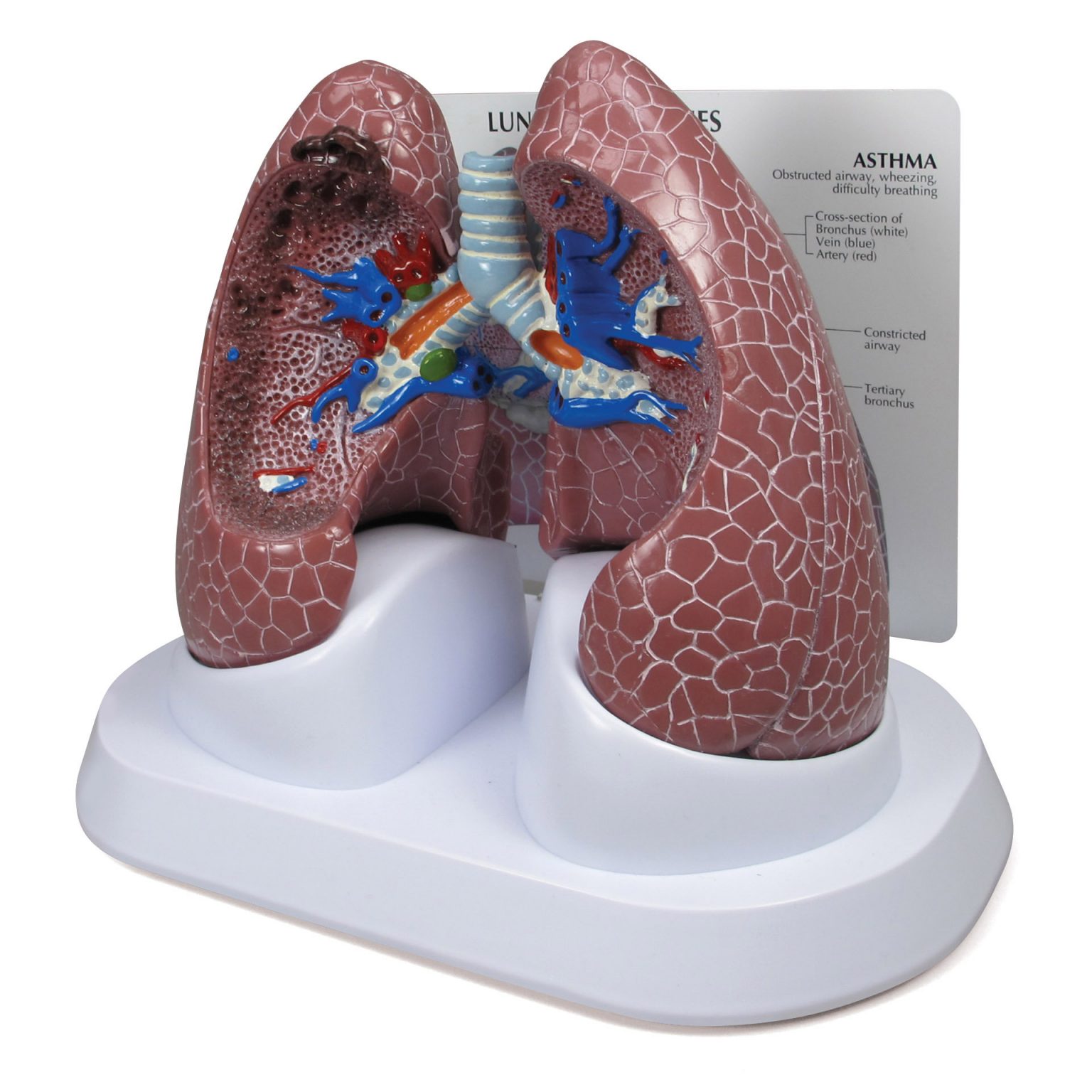 COPD - Model #3130 - GPI Anatomicals