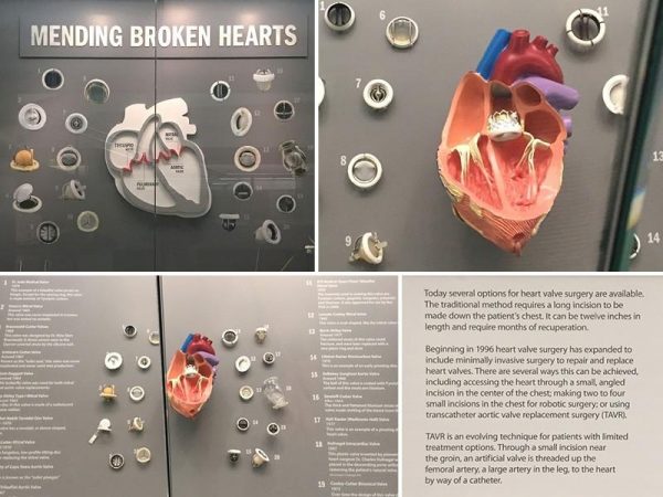 Custom Heart Model on Display at Smithsonian - GPI Anatomicals