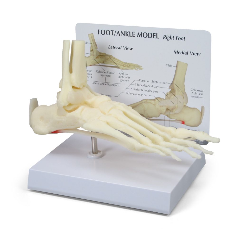 Foot/Ankle - Plantar Fasciitis Model