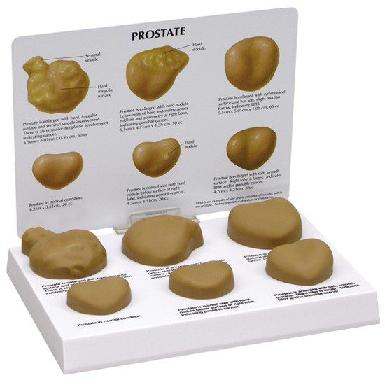 Prostate - Model #3000 - GPI Anatomicals