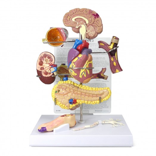 Pancreas - Model #3330 - GPI Anatomicals